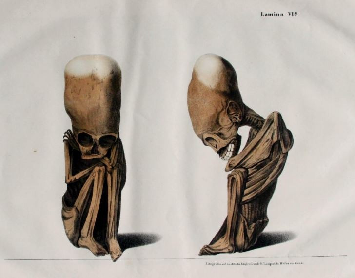 Elongated skulls, without cranial deformation • Neperos