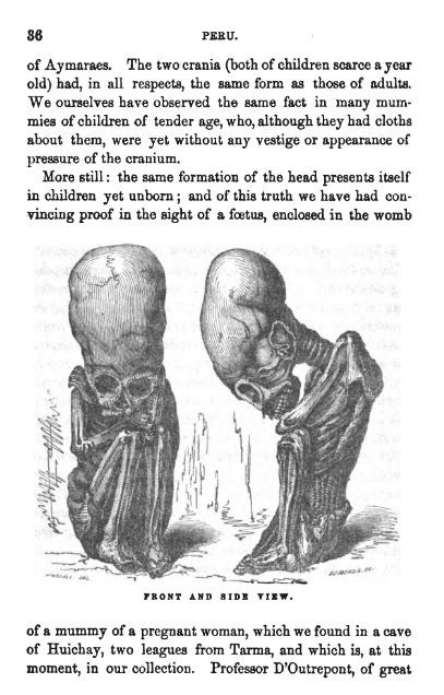 Elongated skulls, without cranial deformation • Neperos