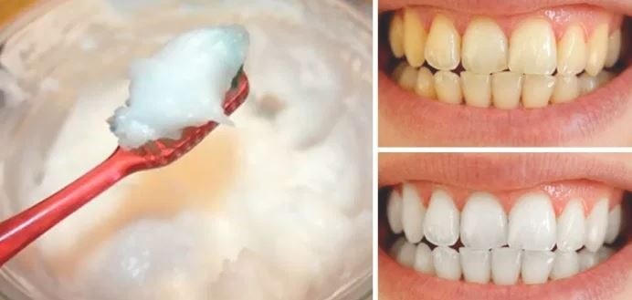 Brighten teeth like pearls without expensive toothpaste • Neperos